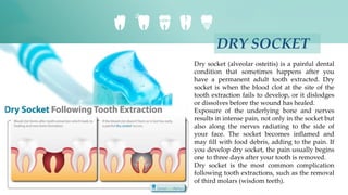 Pathology of pulp and its sequels | PPTX