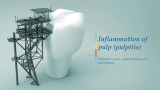 Pathology of pulp and its sequels | PPTX