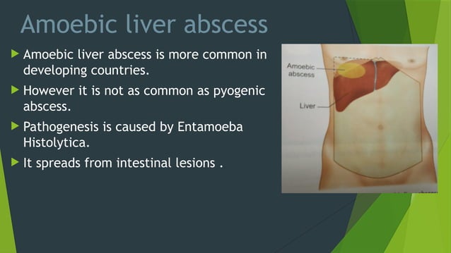 PATHOLOGY OF PYOGENIC AND AMOEBIC LIVER ABSCESS.pptx
