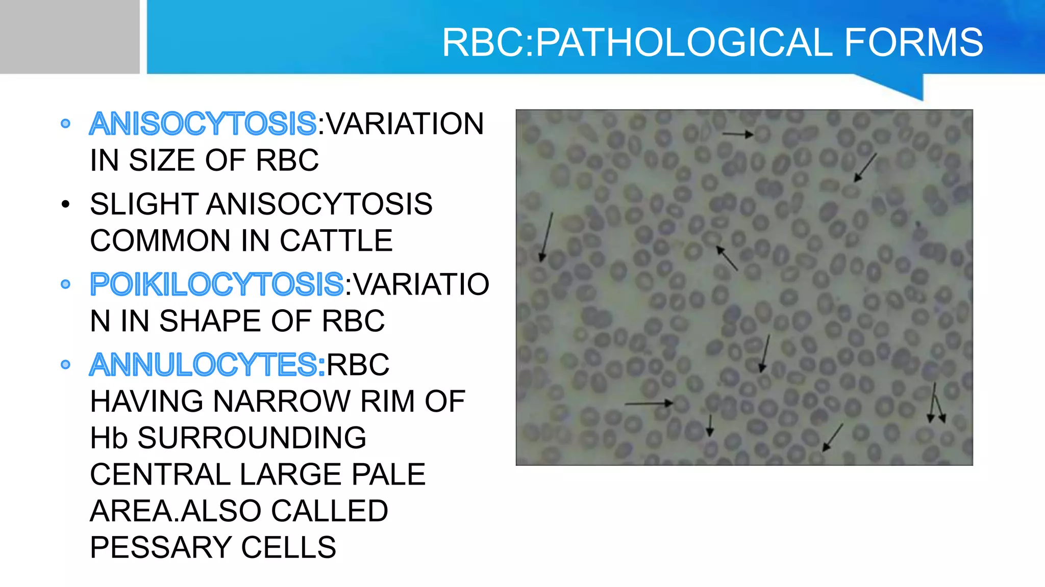 Pathology of rbc and wbc | PPT