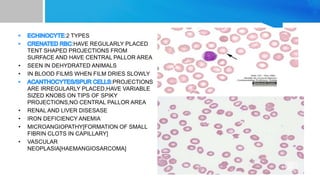 Pathology of rbc and wbc | PPTX