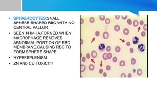 Pathology of rbc and wbc | PPTX