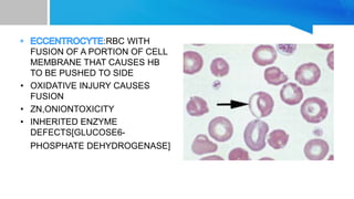 Pathology of rbc and wbc | PPTX