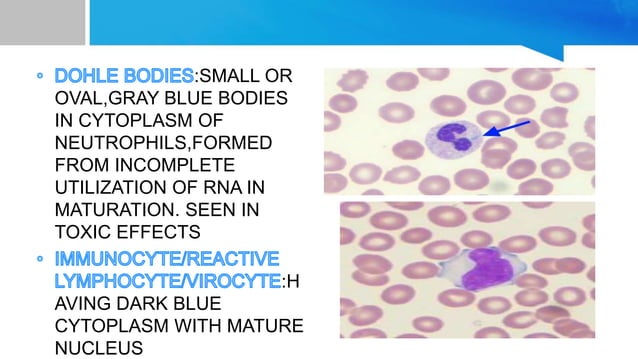 Pathology of rbc and wbc | PPT