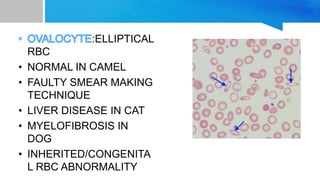 Pathology of rbc and wbc | PPTX