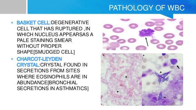 Pathology of rbc and wbc