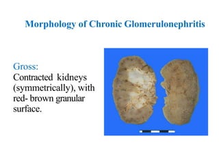 Pathology of Renal system...........pptx