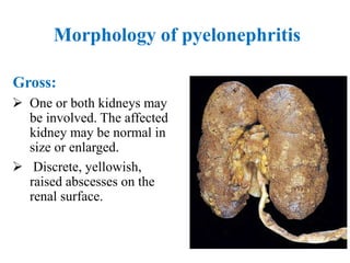 Pathology of Renal system...........pptx
