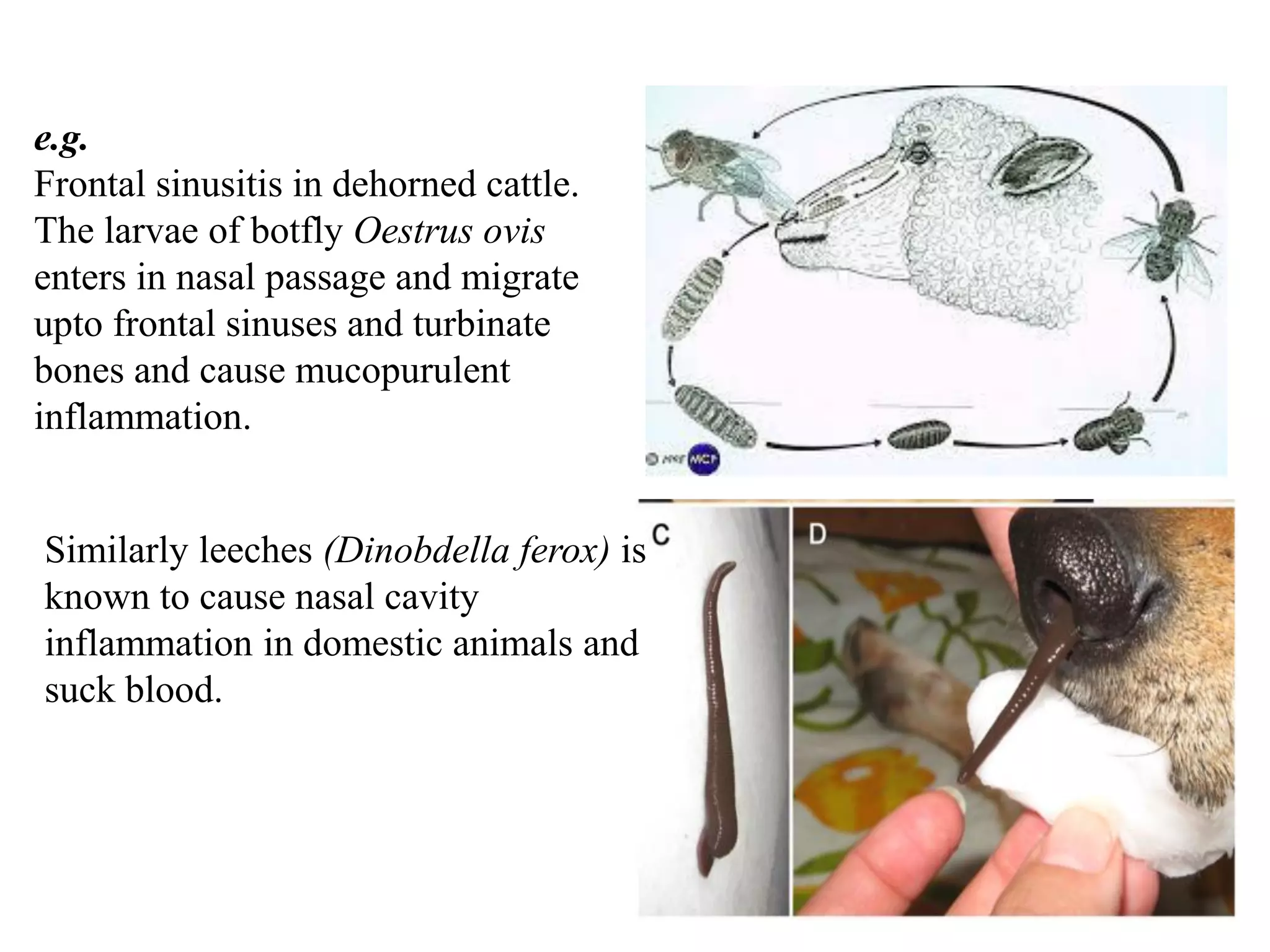 Pathology of respiratory system | PDF