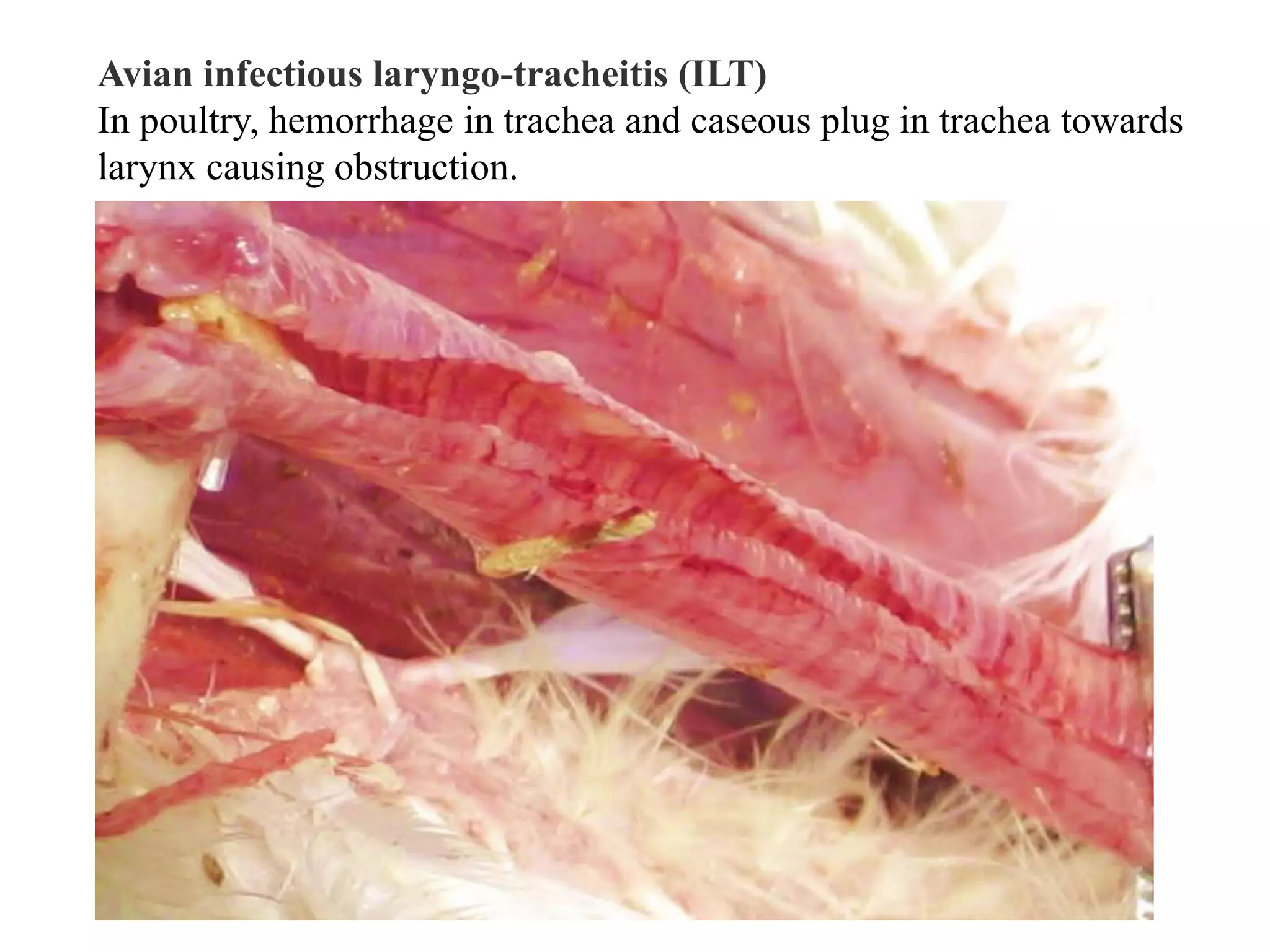 Pathology of respiratory system | PDF