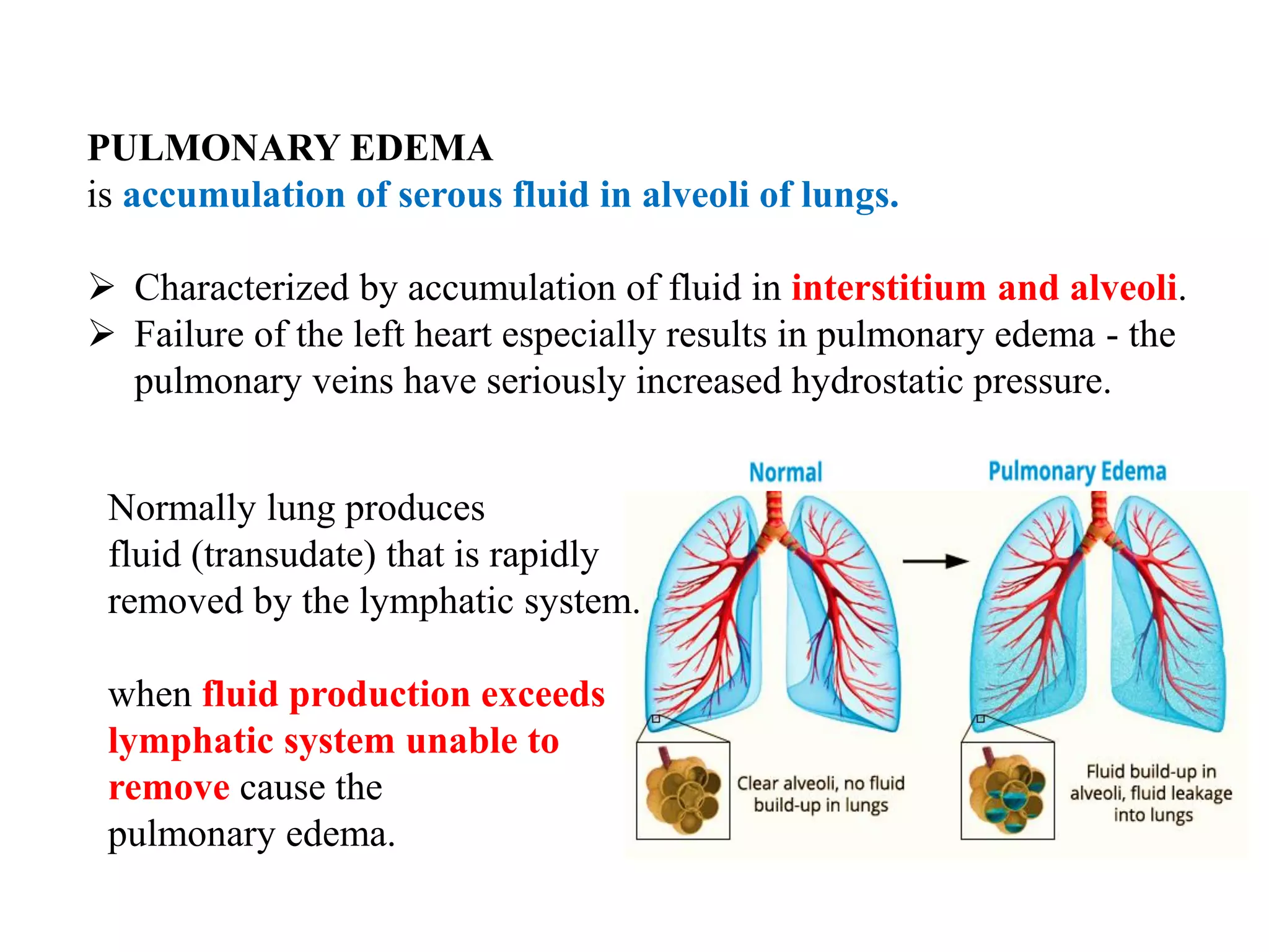 Pathology of respiratory system | PDF