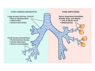 Pathology of respiratory system | PDF