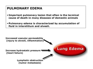 Pathology of respiratory system | PDF