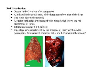 Pathology of respiratory system | PDF