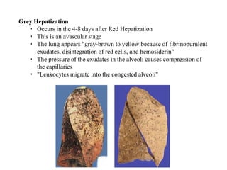 Pathology of respiratory system | PDF