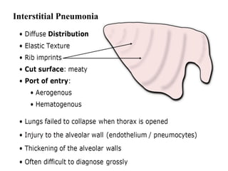 Pathology of respiratory system | PDF