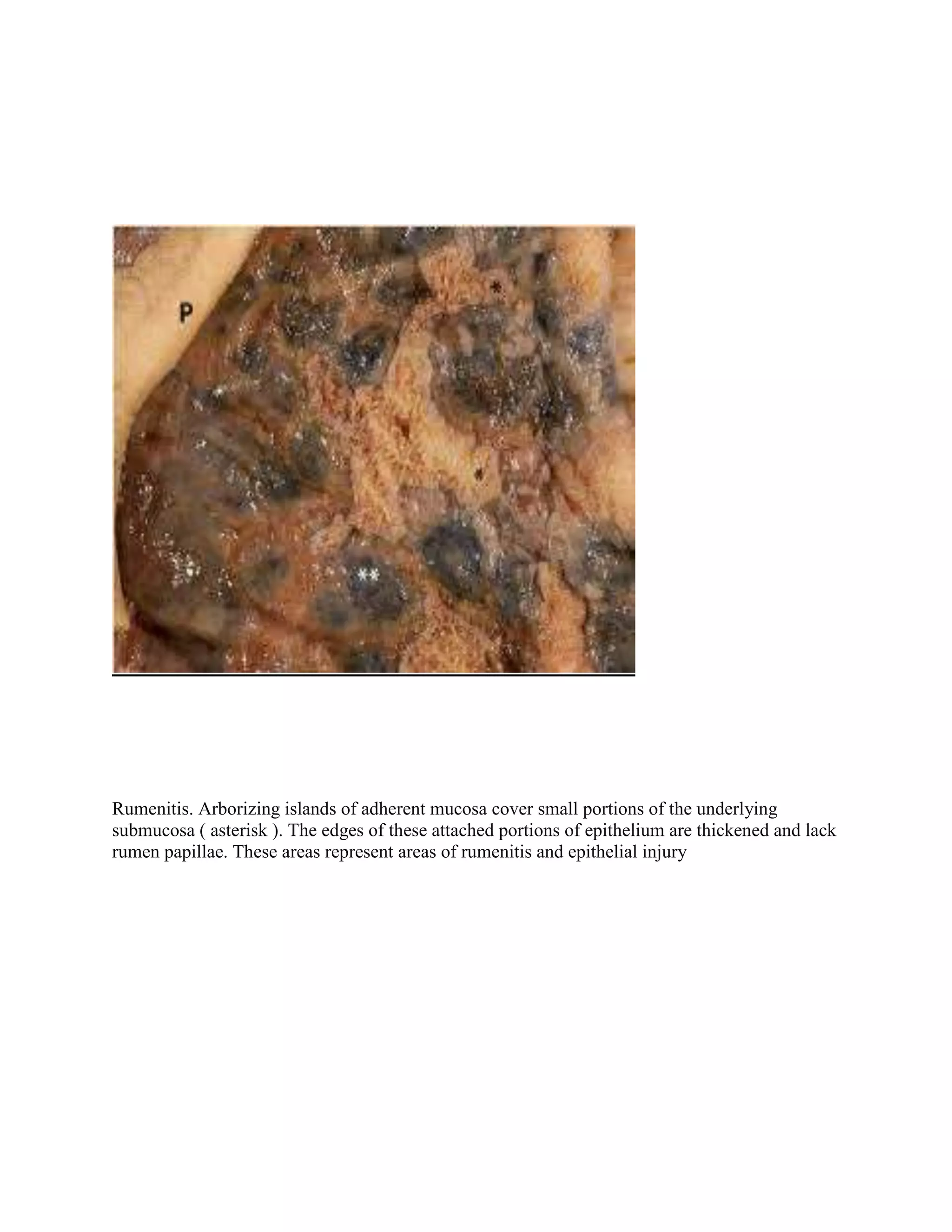 pathology of rumen -- Fahad.docx