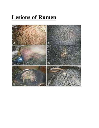 pathology of rumen -- Fahad.docx