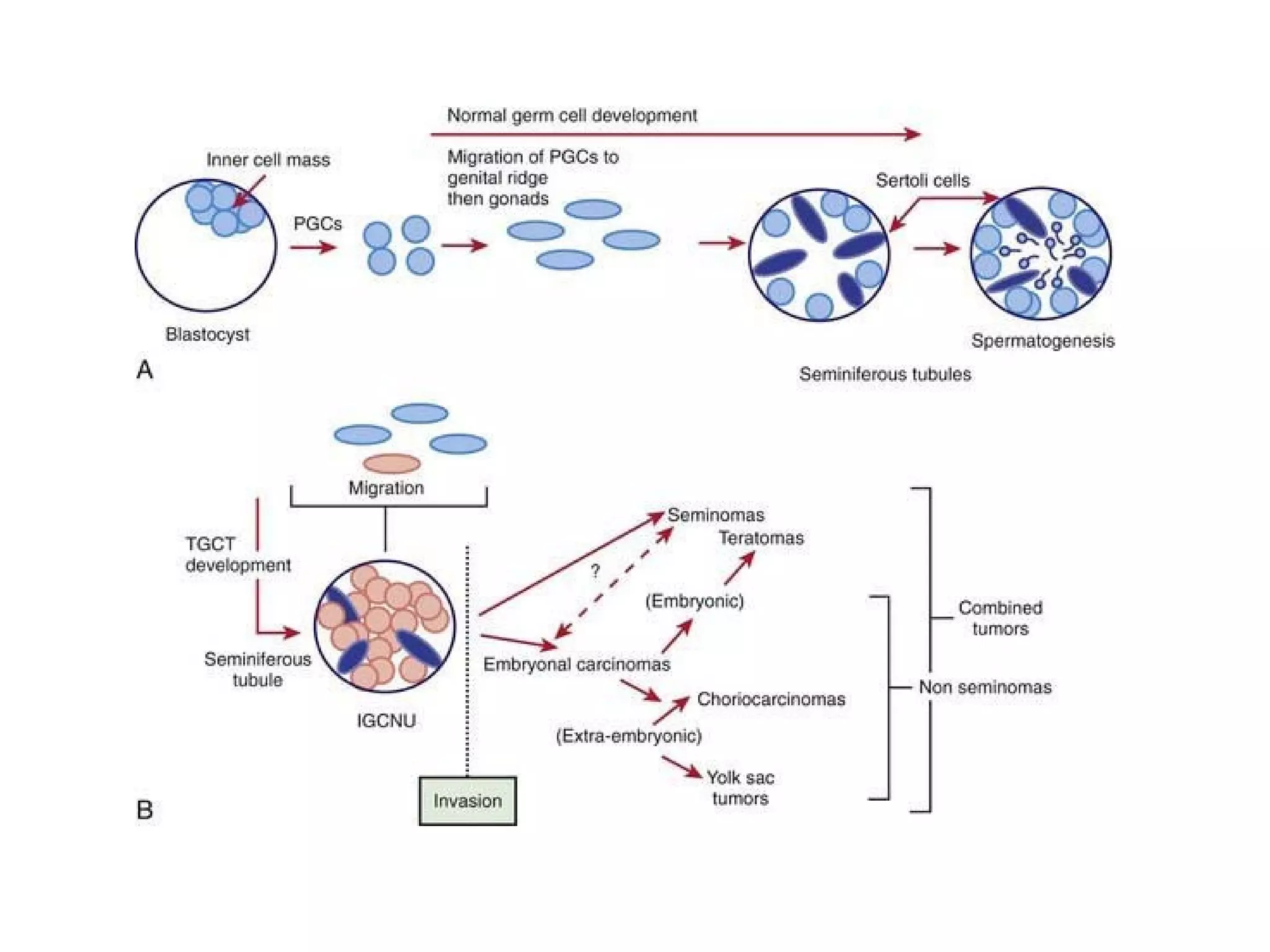 Pathology of testis | PPT