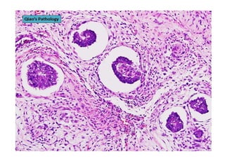 Pathology of testis | PPT