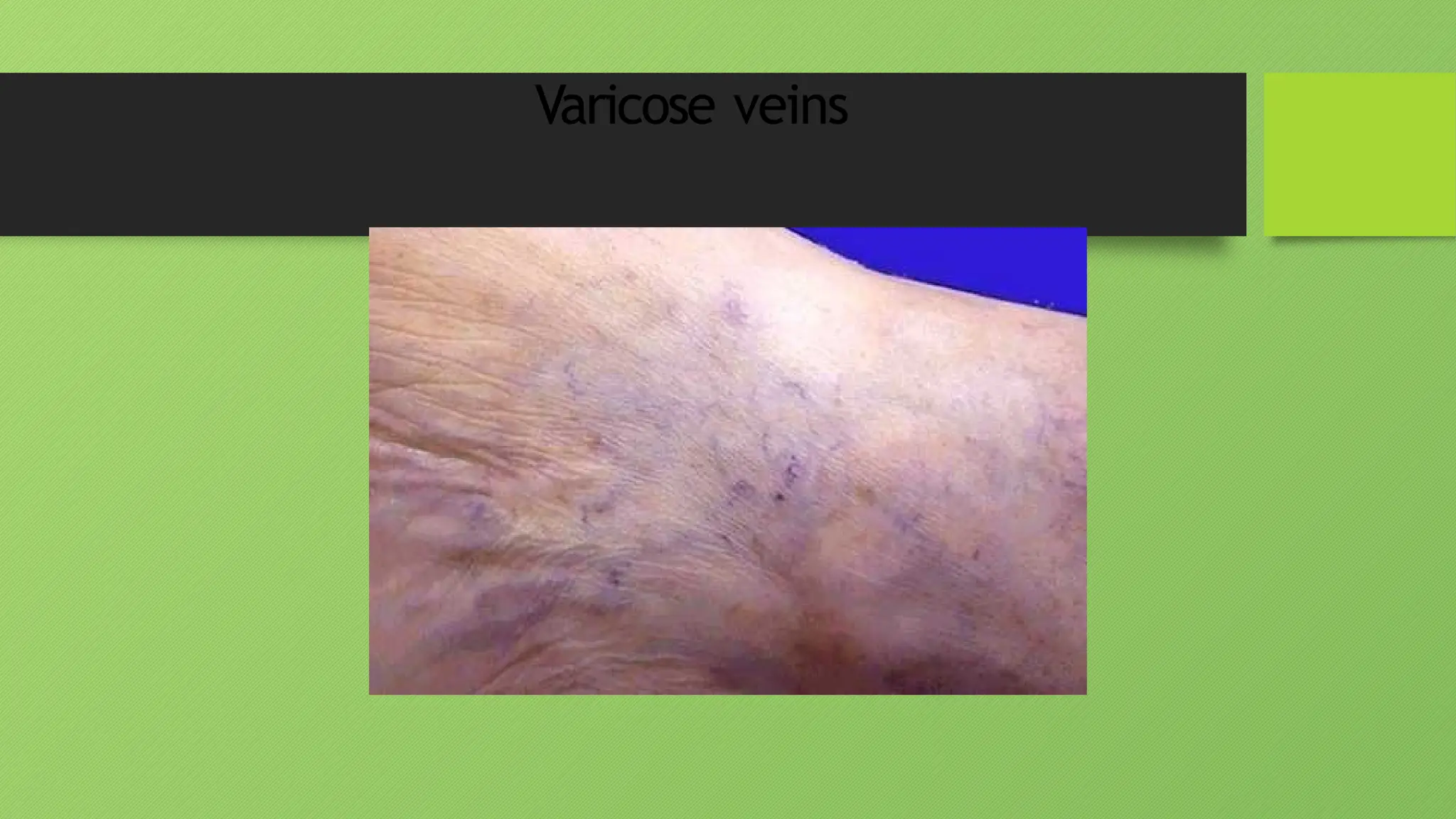 Pathology of the circulatory blood vessels.pptx