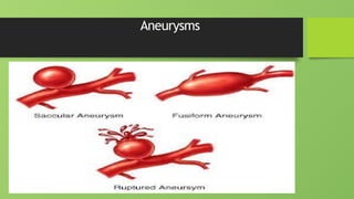Pathology of the circulatory blood vessels.pptx