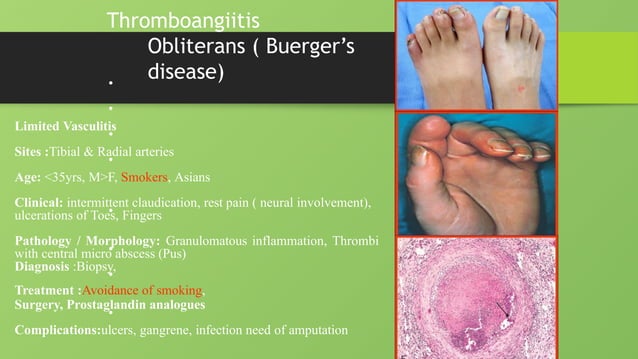 Pathology of the circulatory blood vessels.pptx