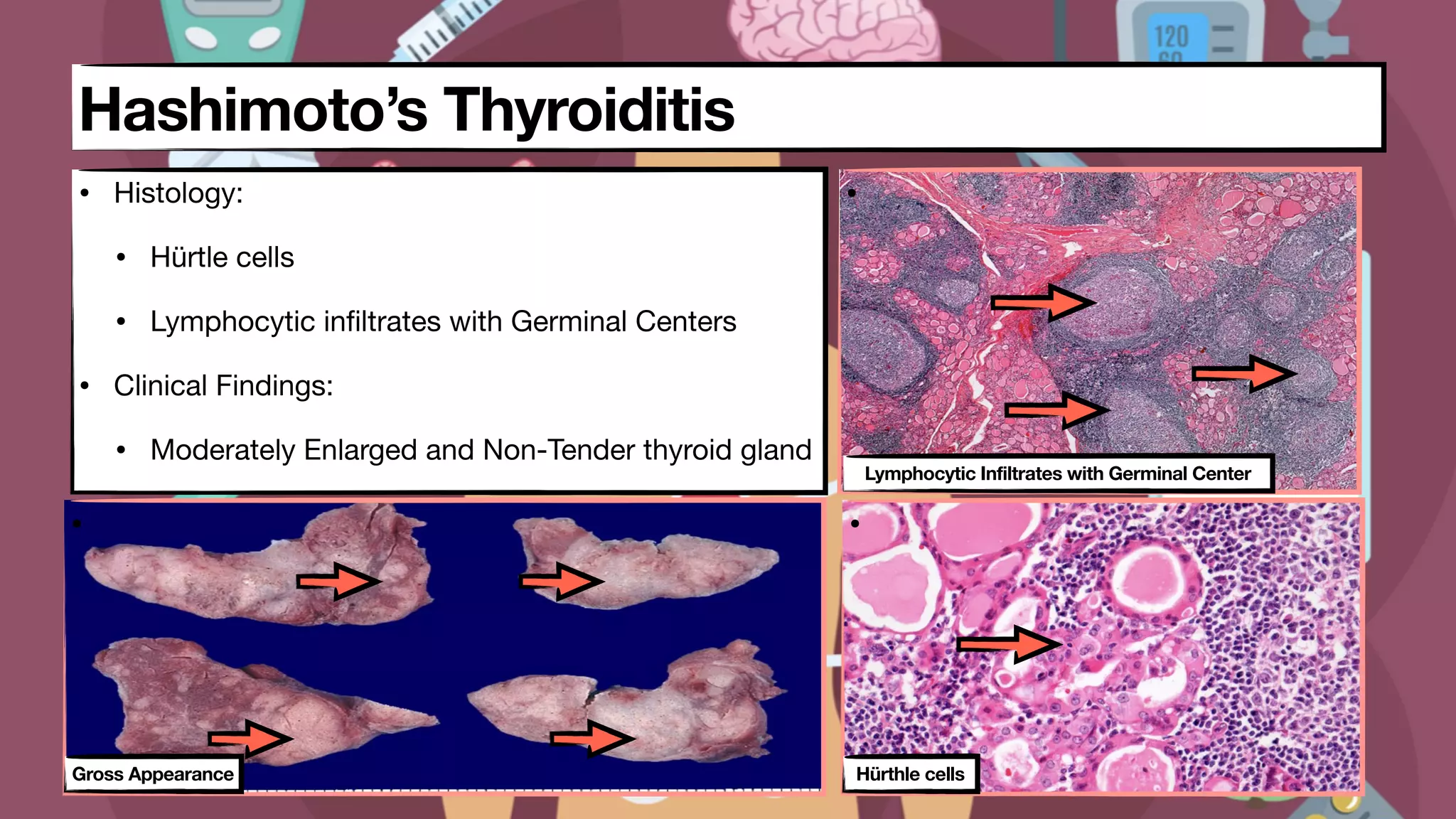 Pathology of the Endocrine System.pdf