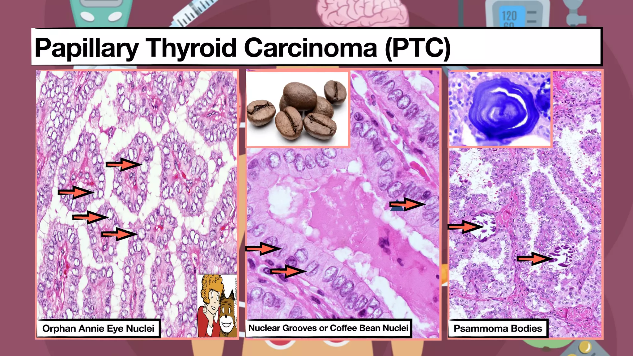 Pathology of the Endocrine System.pdf