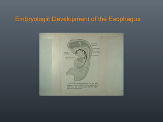 Pathology of the esophagus | PPT