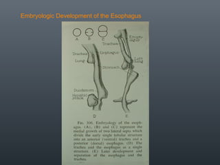 Pathology of the esophagus | PPT