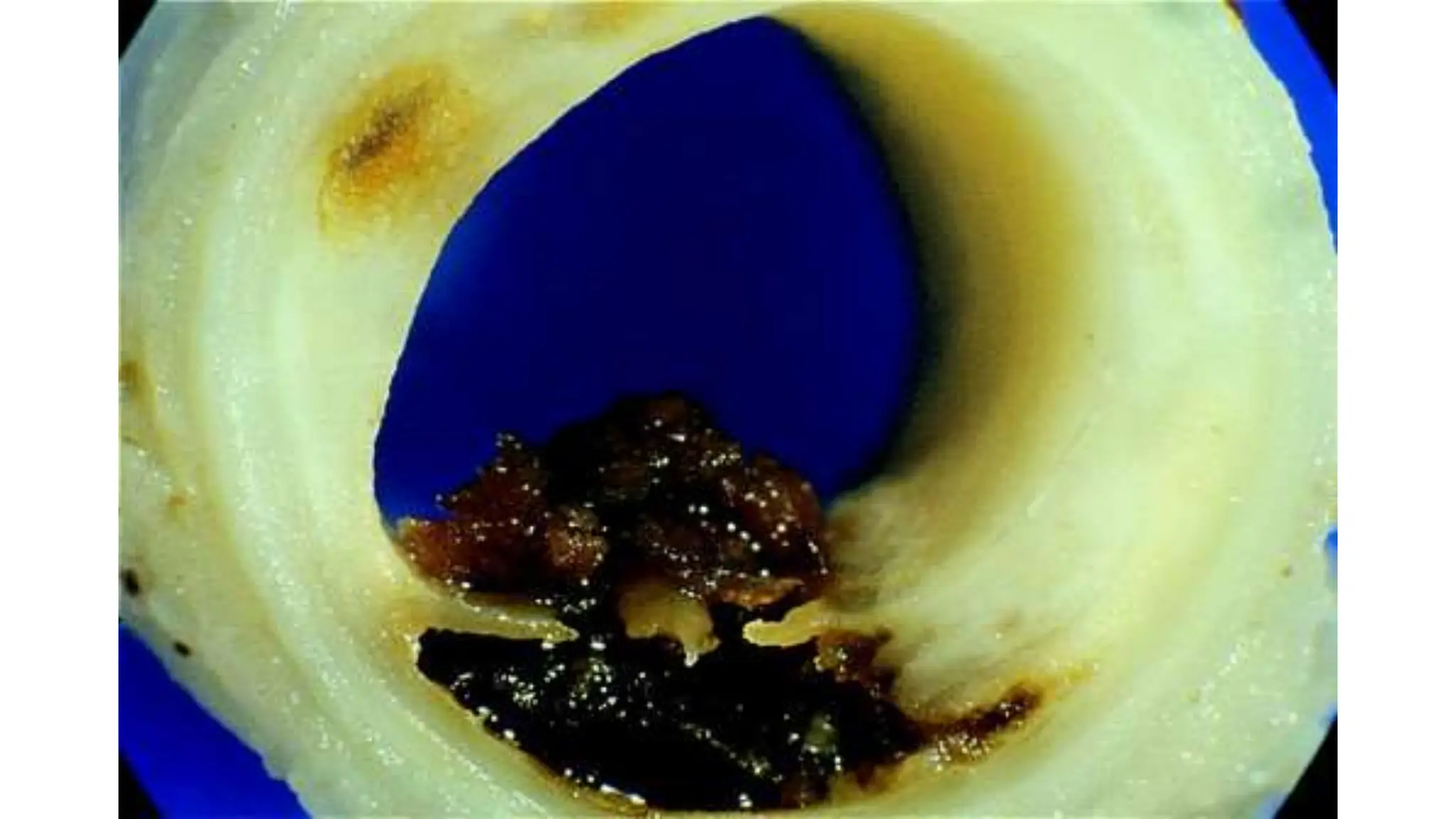 Pathology of the heart.. Disorders of heart | PPT