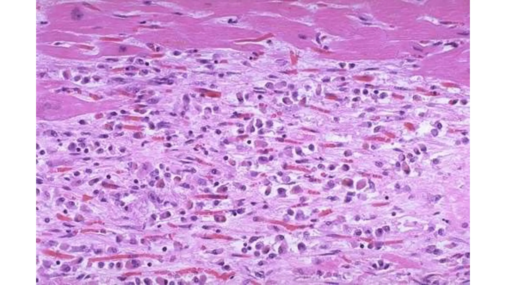 Pathology of the heart.. Disorders of heart | PPT