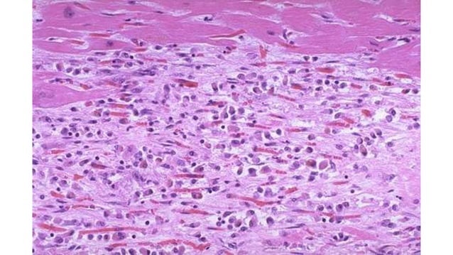 Pathology of the heart.. Disorders of heart | PPT