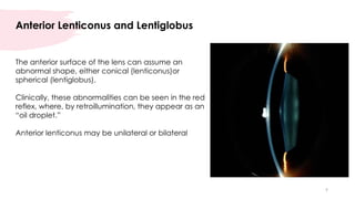 A short dive into the patholpgy of the human lens and how to reach it ...