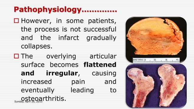 Pathology of the musculoskeletal system 1 | PPSX