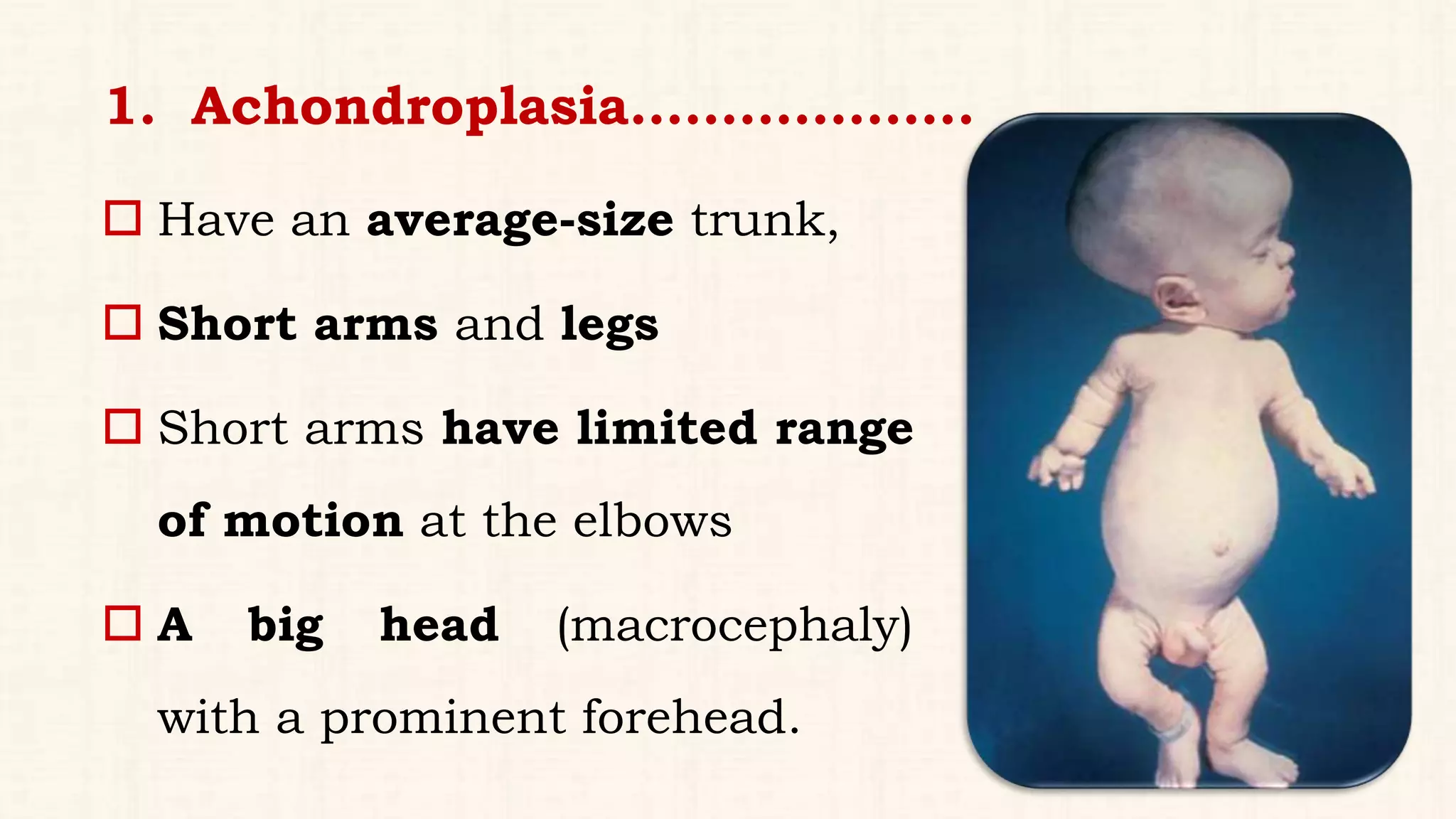 Pathology of the musculoskeletal system 2016 | PPTX