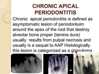 Pathology of the periapex | PPTX