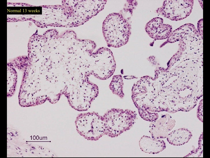 Pathology of the_placenta_-_lecture