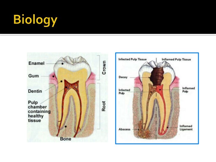 Pathology of the pulpal and periradicular tissues 2012 2013