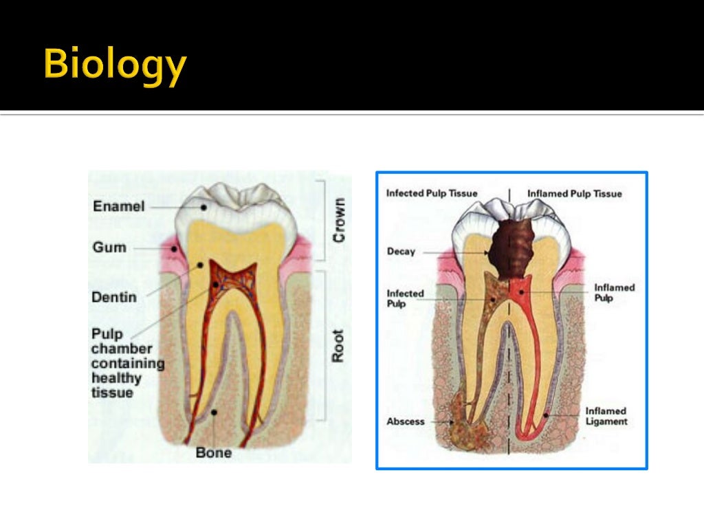 Pathology of the pulpal and periradicular tissues 2012 2013