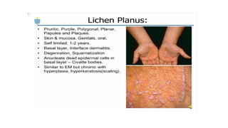PATHOLOGY OF THE SKIN POWERPOINT PRESENTATION...... Lichen Planus,Psoriasis,ImpetigoUrticaria | PPTX