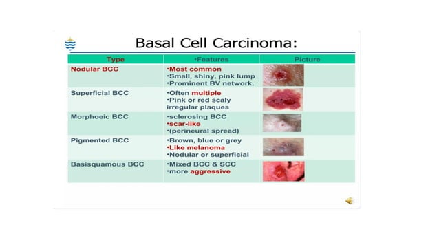 PATHOLOGY OF THE SKIN POWERPOINT PRESENTATION...... Lichen Planus ...