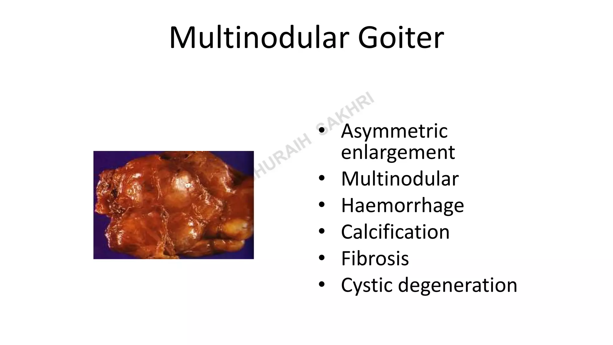 Pathophysiology of the thyroid gland | PPT