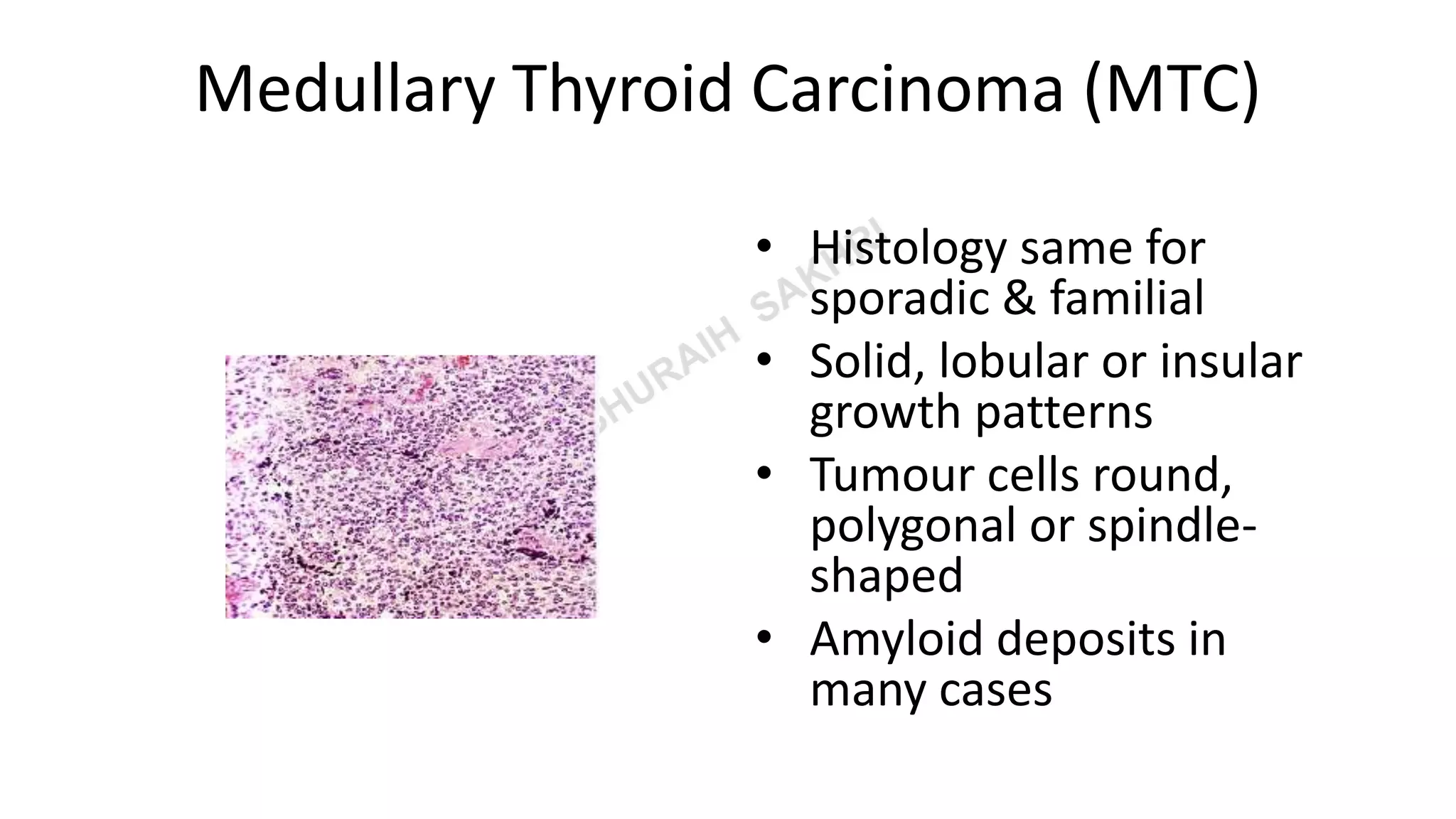 Pathophysiology of the thyroid gland | PPT
