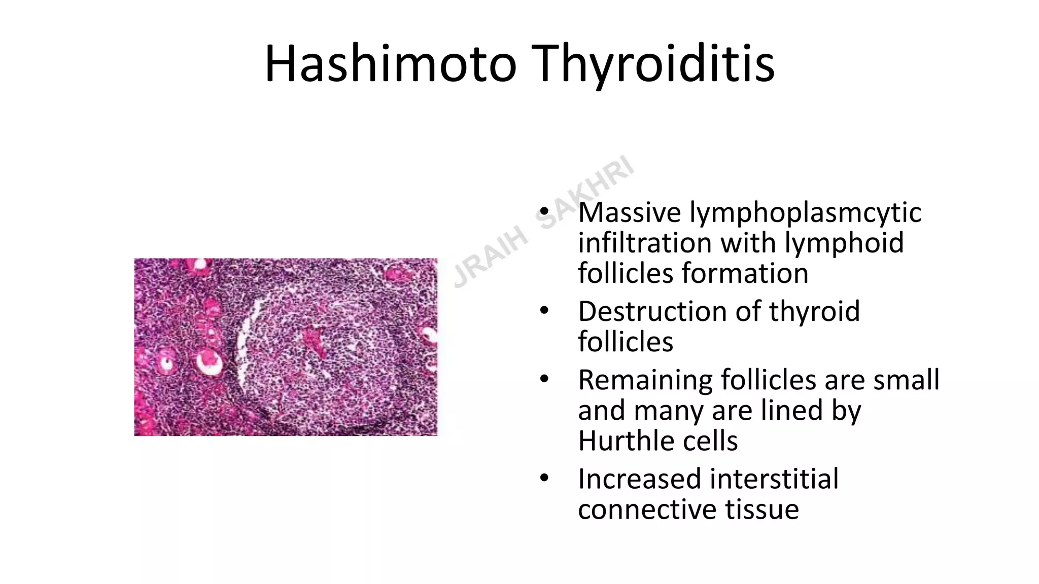 Pathophysiology of the thyroid gland | PPT