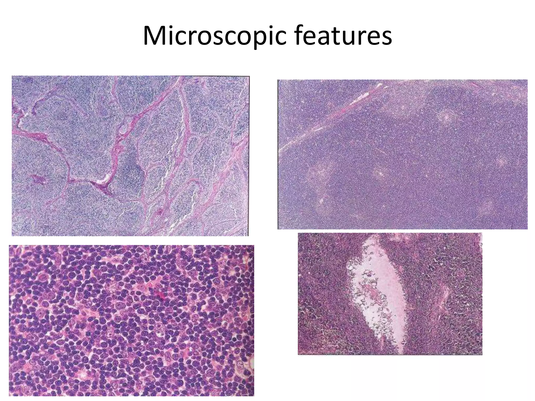 Pathology of thymus | PPTX