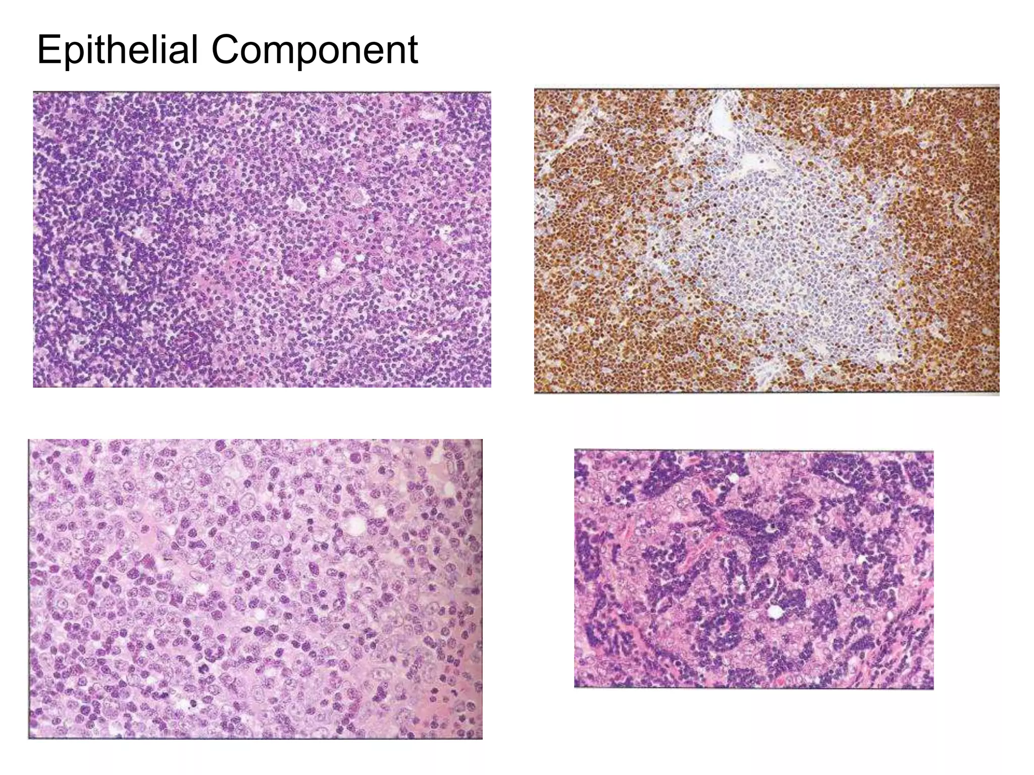 Pathology of thymus | PPTX