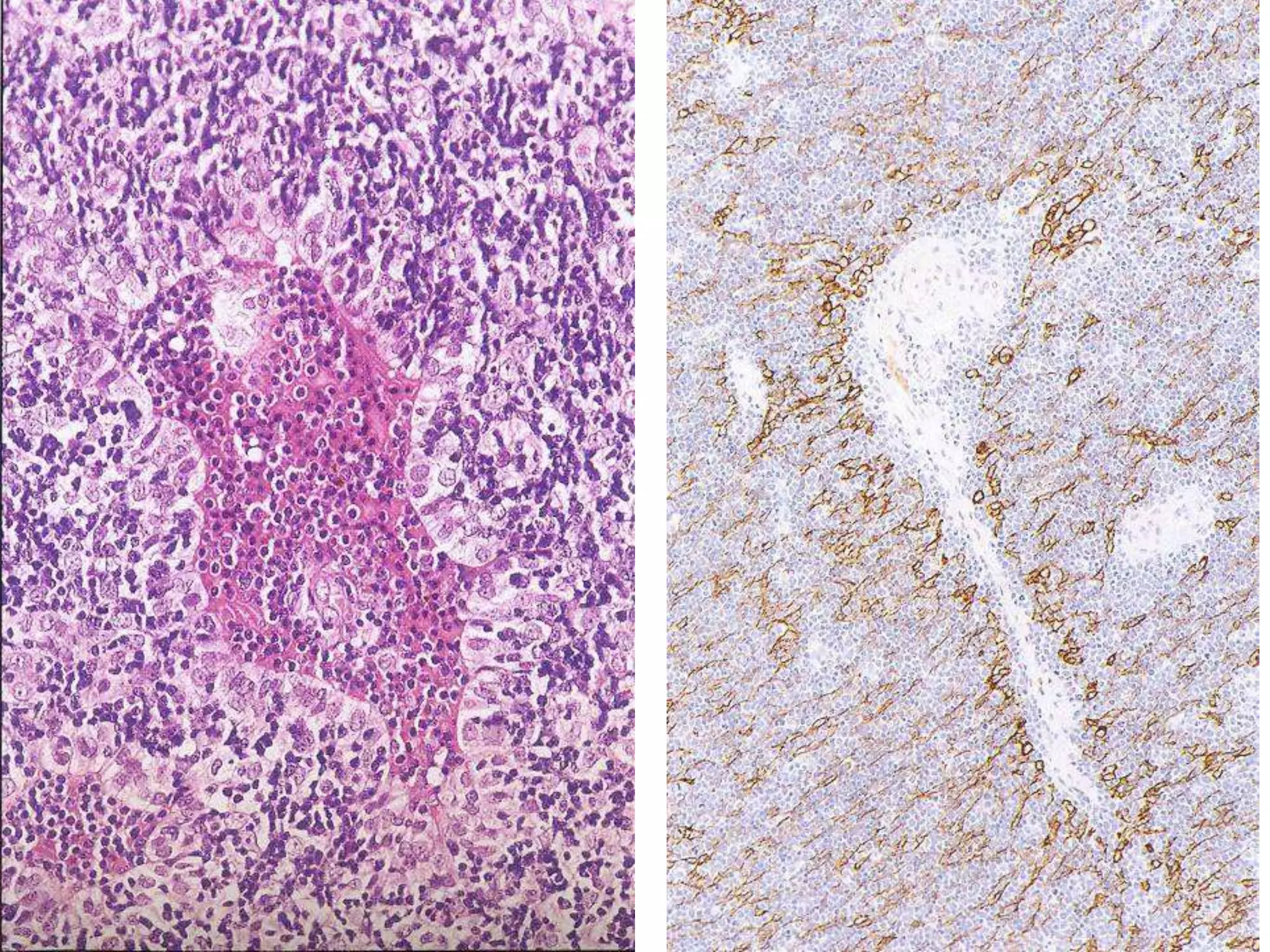Pathology of thymus | PPTX
