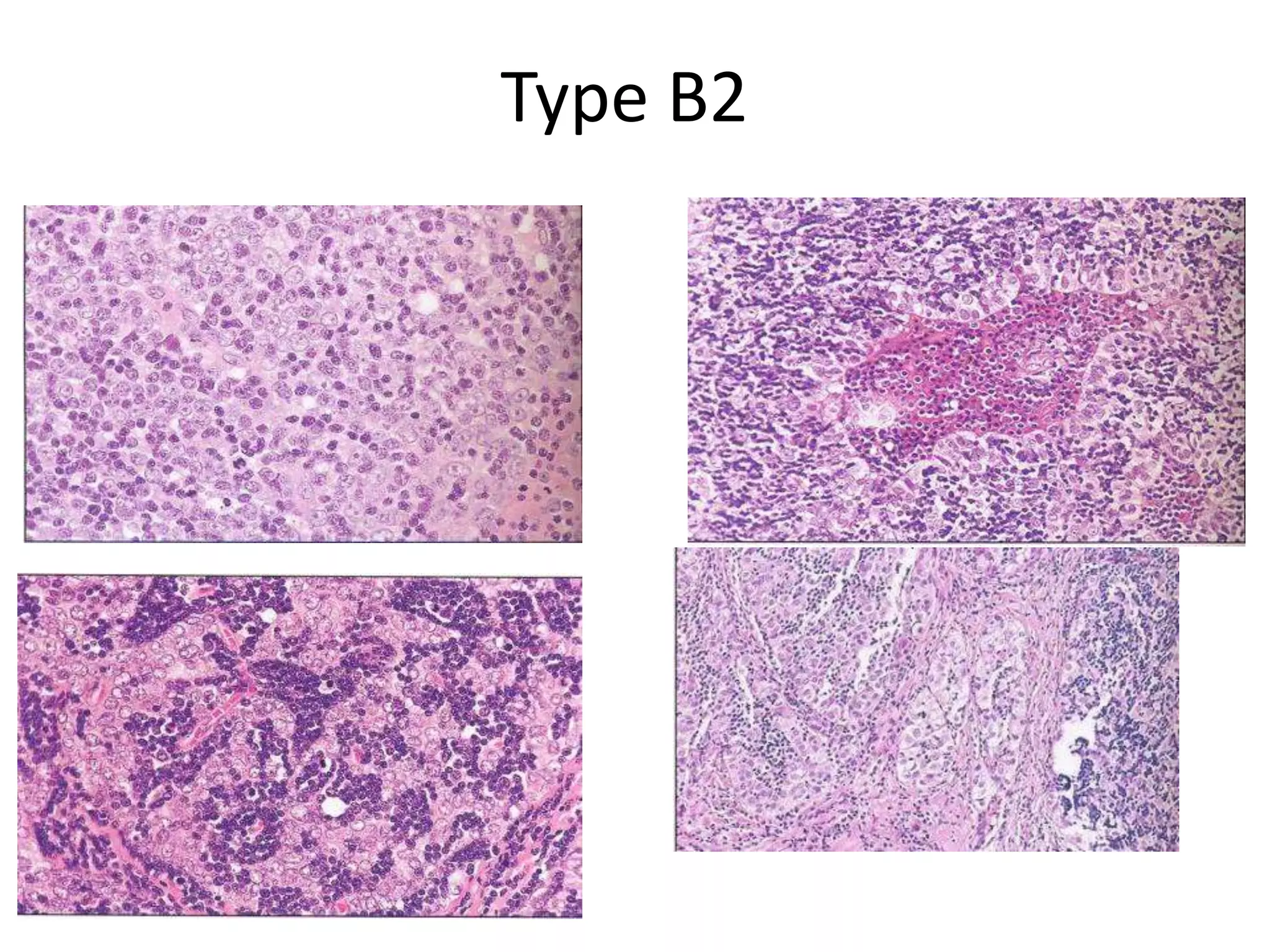 Pathology of thymus | PPTX